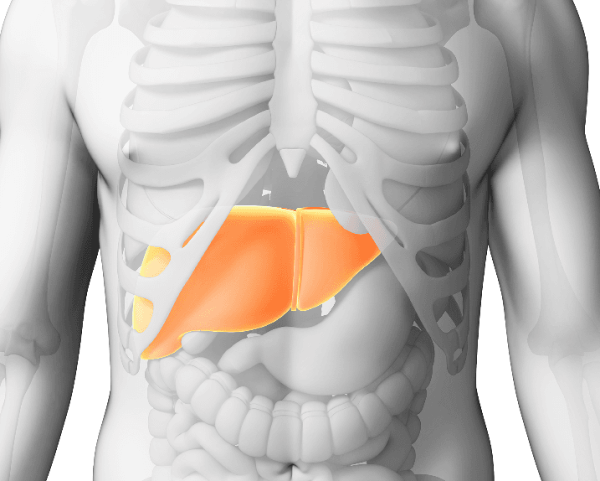 Masna jetra - steatoza