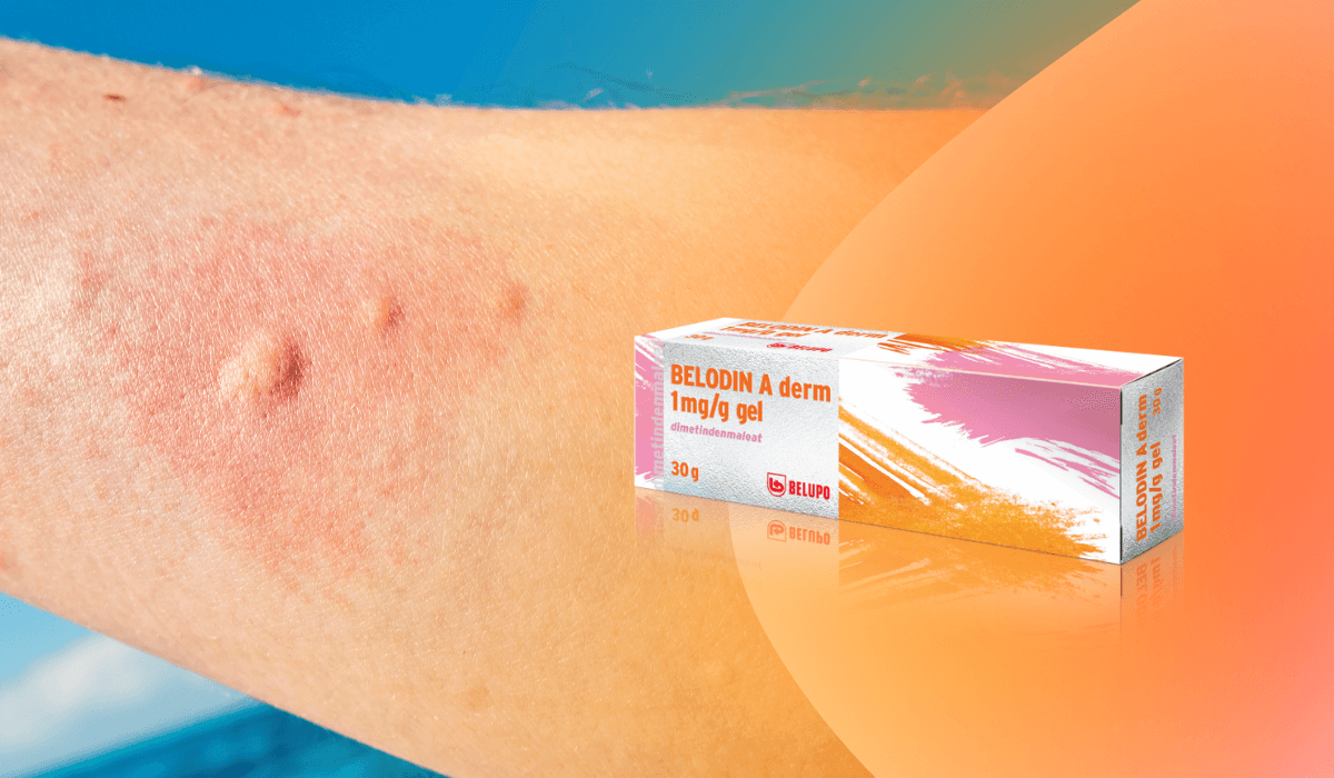 Pomoć kod alergija na sunce i uboda kukaca